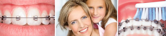 Dr. Gregor Steinbach | Speed-Brackets